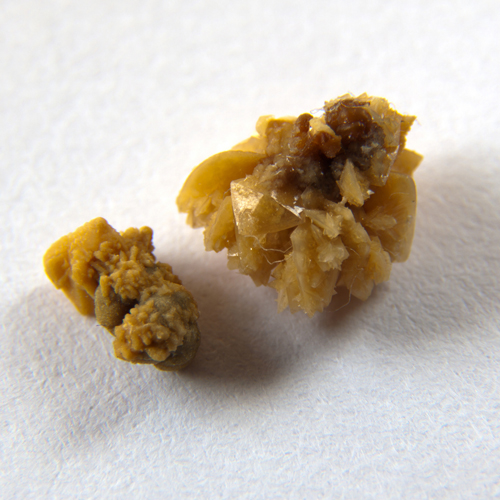 Management of Calculi (stones) in the Urinary Tract | West Coast Urology