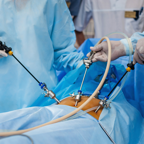 Reconstructive Urology | West Coast Urology